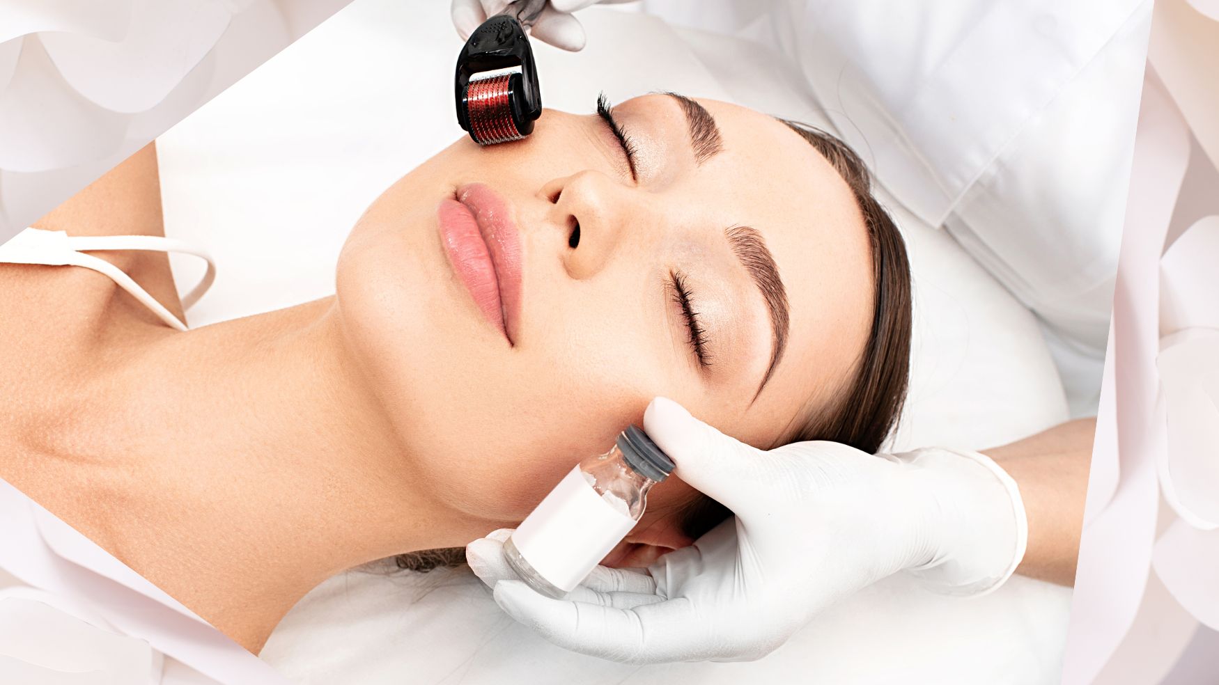 Benefits of Micro-needling with Derma Roller